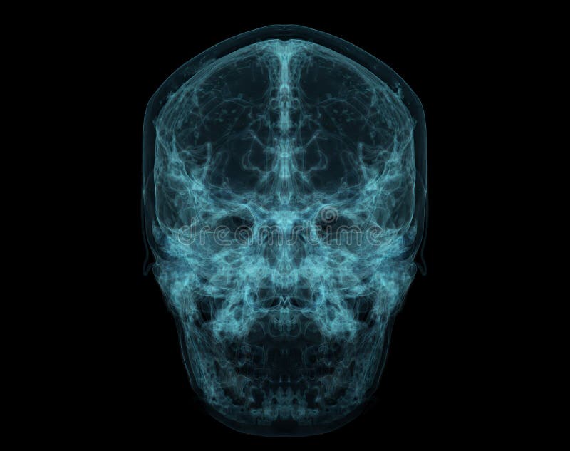 Human Skull, Brain by CT Scan. X-ray Visualization Inside of Skull ...