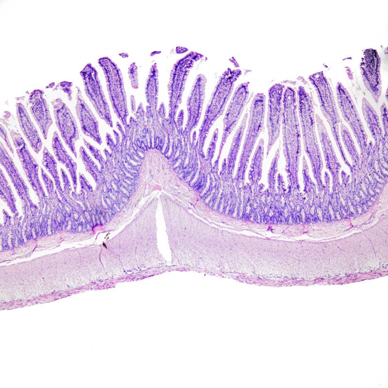 Human Small intestine stock image. Image of system, health - 343906749