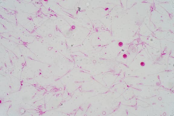 Human Sperm Morphology Under Microscope Stock Image - Image of issues ...