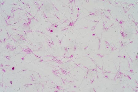 Human Sperm Morphology Under Microscope. Stock Photo - Image of body ...