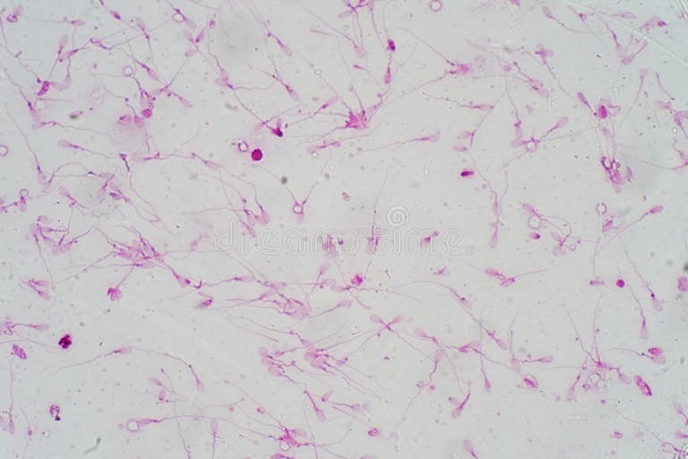 Human Sperm Morphology Under Microscope. Stock Photo - Image of body ...