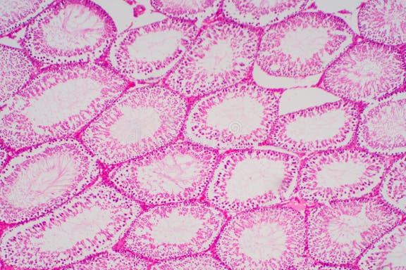 Human Sperm in the Testis Morphology Under Microscope Stock Image ...