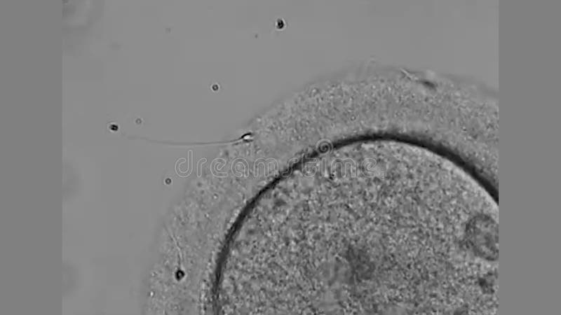 Human Sperm Under the Microscope at Petri Dish with Many Spermatozoa ...