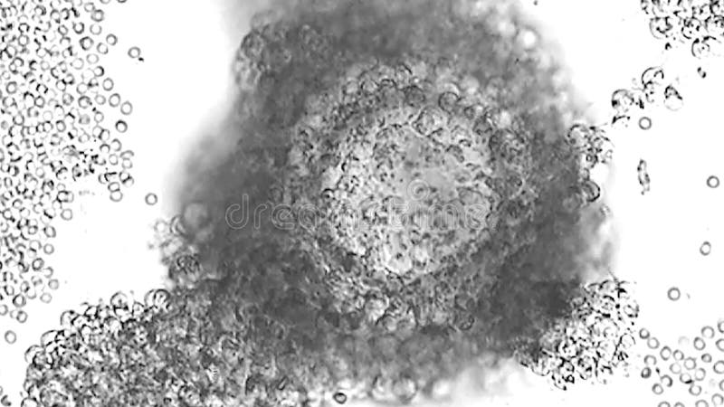 Human Sperm Under the Microscope at Petri Dish with Many Spermatozoa ...