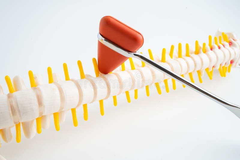 Human Spinal Nerve and Bone with Percussion Reflex Hammer, Model for ...