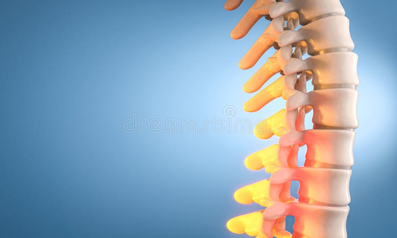 Human Spine Showing Intervertebral Discs and Vertebrae with Back Pain ...