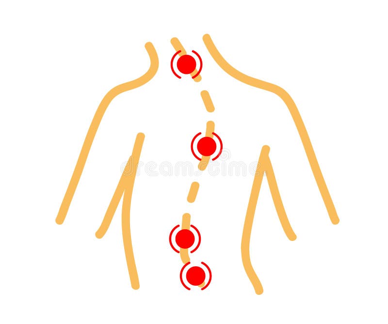 Crooked Posture Stock Illustrations – 36 Crooked Posture Stock ...