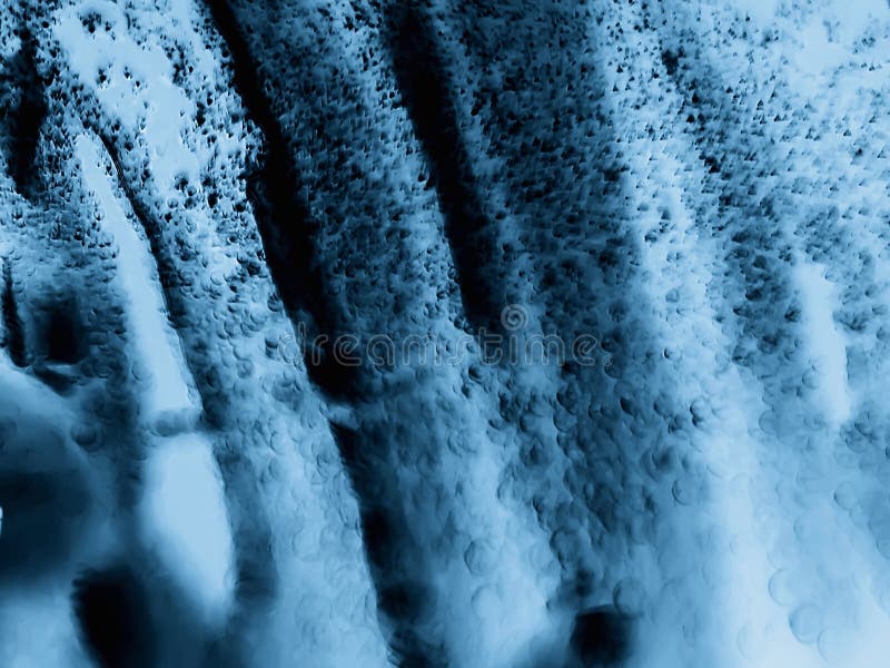 Human Squamous Cell Carcinoma. Tissues Affected by Cancer Cells Under a ...