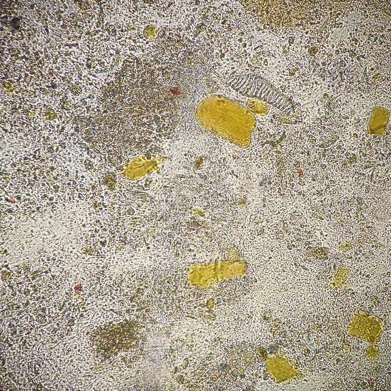 Human Stool Sample Under Microscope Stock Image - Image of nature ...