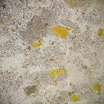 Human Stool Sample Under Microscope Stock Image - Image of nature ...