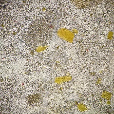 Human Stool Sample Under Microscope Stock Image - Image of nature ...