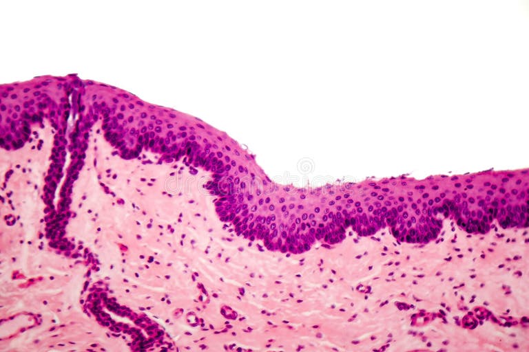 2,334 Squamous Epithelium Stock Photos - Free & Royalty-Free Stock ...