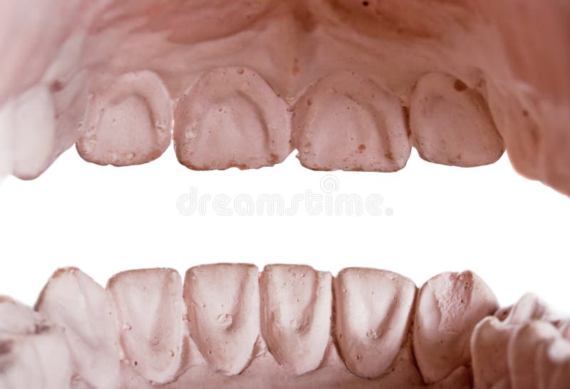 Human teeth stock image. Image of braces, healthy, conceptual - 5146949