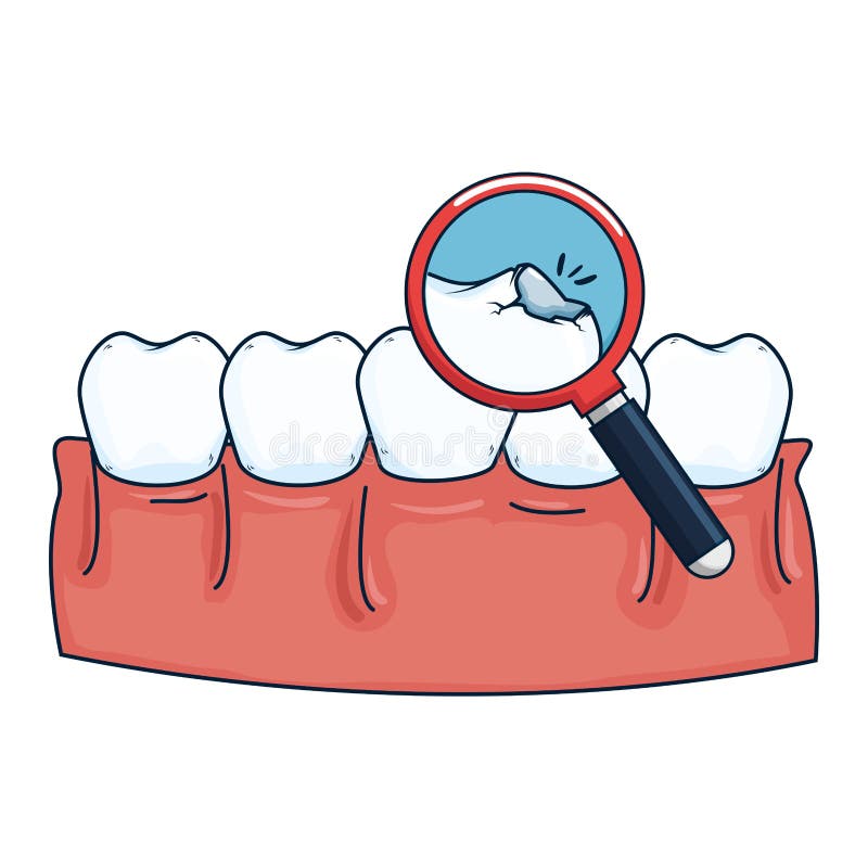 Human Tooth And Magnifying Glass. Vector Illustration Stock Vector ...