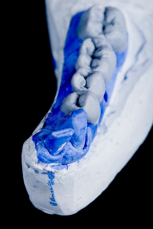 Human teeth, model stock photo. Image of anatomical, bite - 5146852