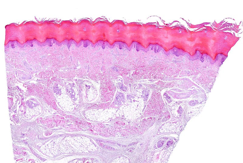 Human Thick Skin. Sole of the Foot Stock Image - Image of dermis, layer ...