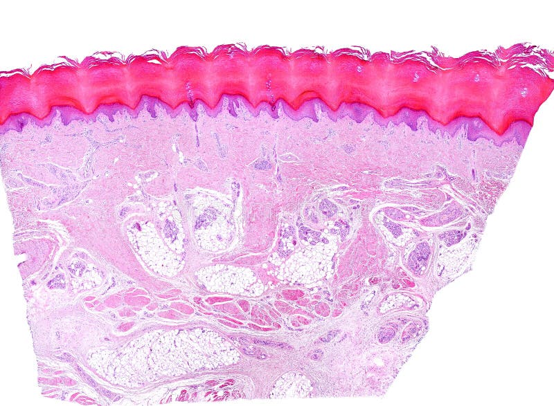 Human Thick Skin. Sole of the Foot Stock Photo - Image of microscopy ...