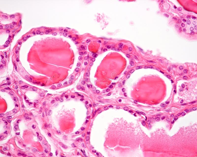 Human Thyroid Gland. Follicles Stock Image - Image of cells ...