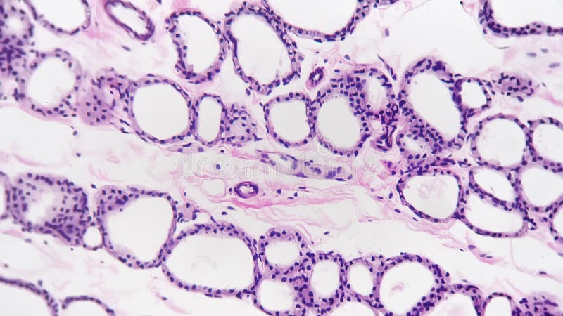 Thyroid Gland of the Human in Section Filmed Under Microscope 400x ...