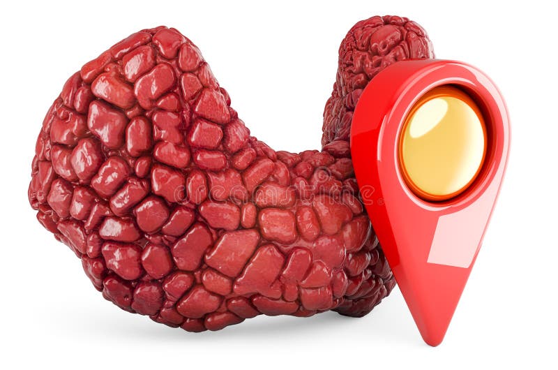 Human Thyroid with Shackle. Thyroid Disease Concept Stock Illustration ...