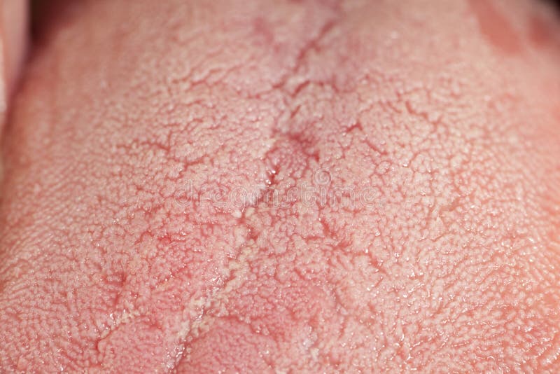 Human tongue texture stock photo. Image of papilla, closeup - 28622740