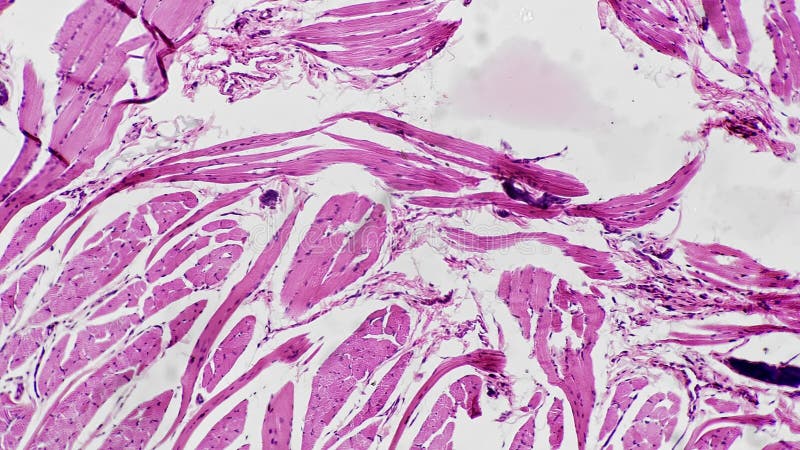 Human Tongue in Longitudinal Section Showing Filiform Papillae Under ...