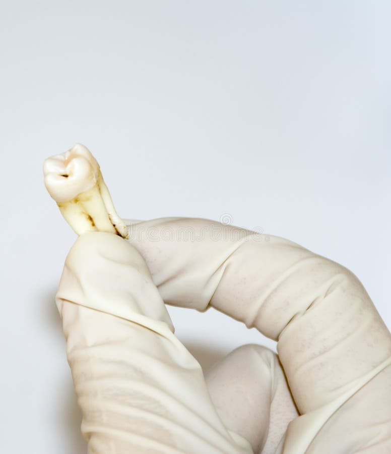 Aggressive teeth stock image. Image of bone, yellow, human - 6808471