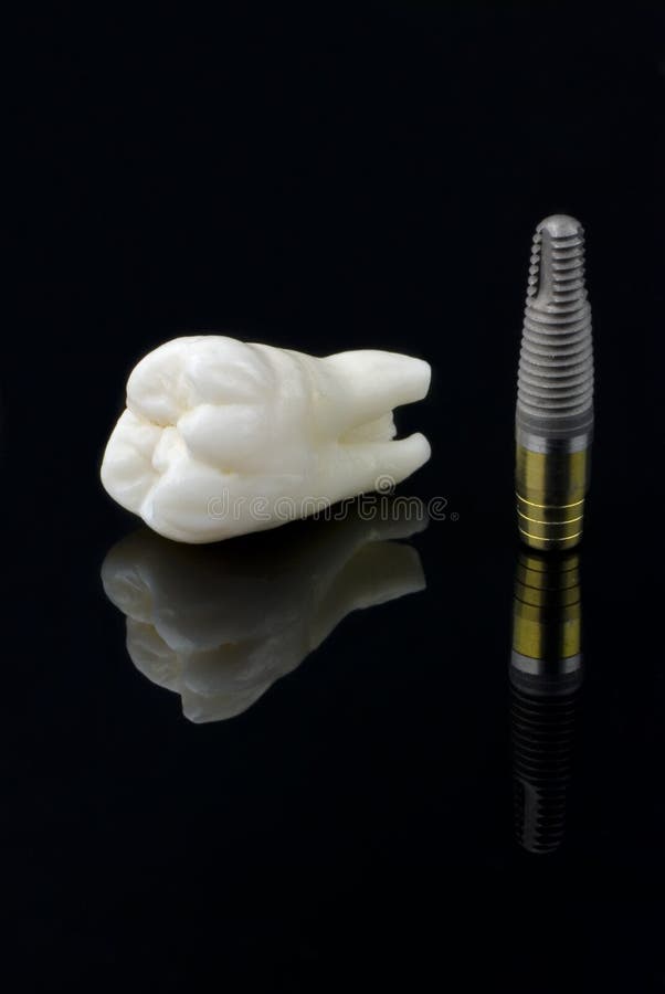 Wisdom Tooth, Implant and Teeth Model Stock Image - Image of equipment ...