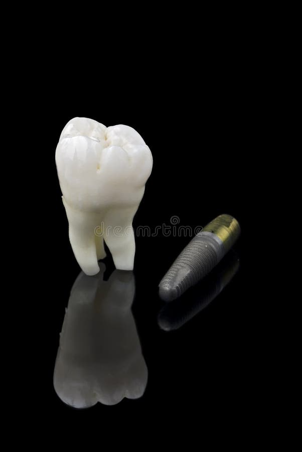 Human Tooth and Titanium Implant Stock Image - Image of mouth, roots ...