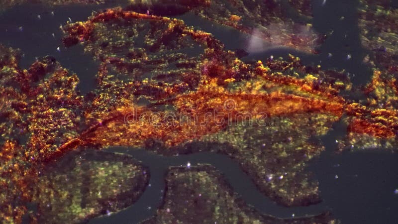 Transitional Epithelium of Man in Section Filmed Under Microscope 400x ...