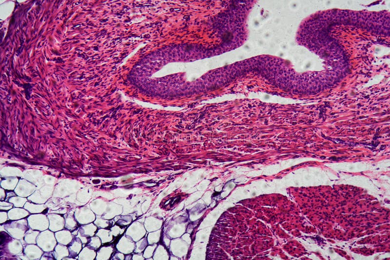 Transitional Epithelium Slide