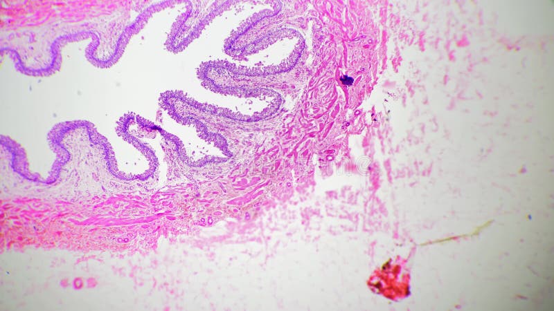Human Urethra in Section with 400 Magnification Shown Under Microscope ...