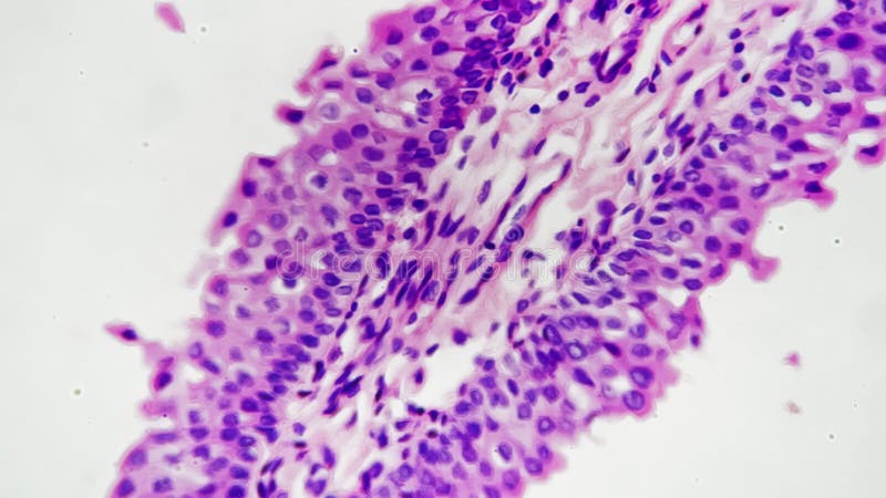 Human Urethra in Section with 400 Magnification Shown Under Microscope ...