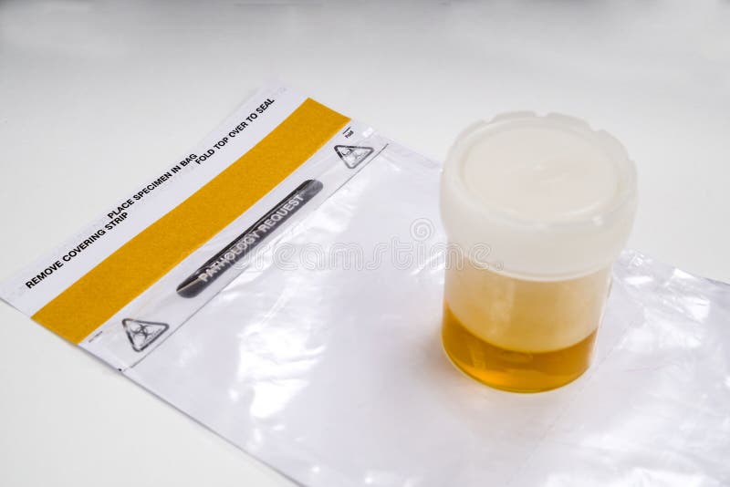 Human Urine Sample. stock image. Image of rectal, photograph - 112191233