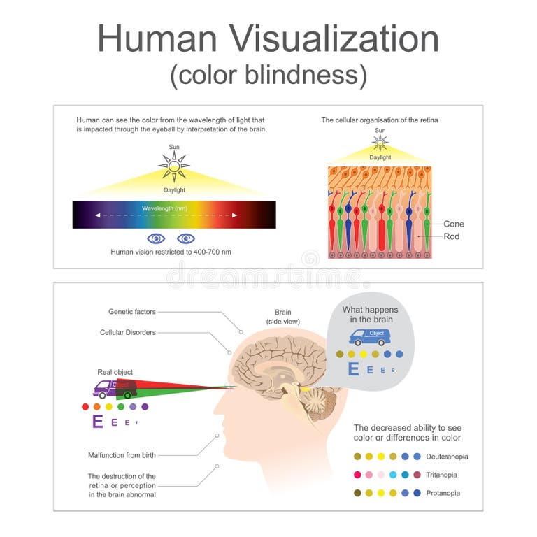 Human Visualization Color Blindness. Stock Vector - Illustration of ...