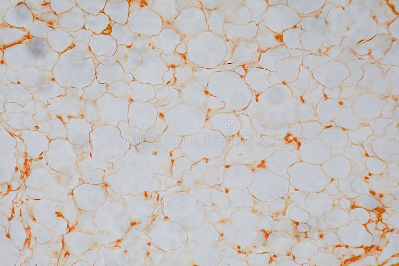 Human body fat cells stock photo. Image of gain, graphic - 101065264