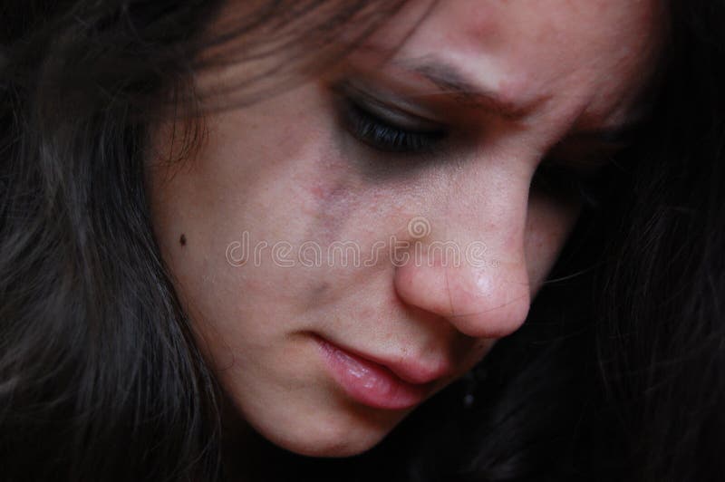 Hurt stock image. Image of sadness, hurting, caucasian - 15384409
