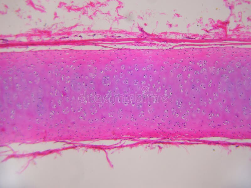 Hyaline Kraakbeen Met Chondrocyten Stock Afbeelding - Image of lacune ...