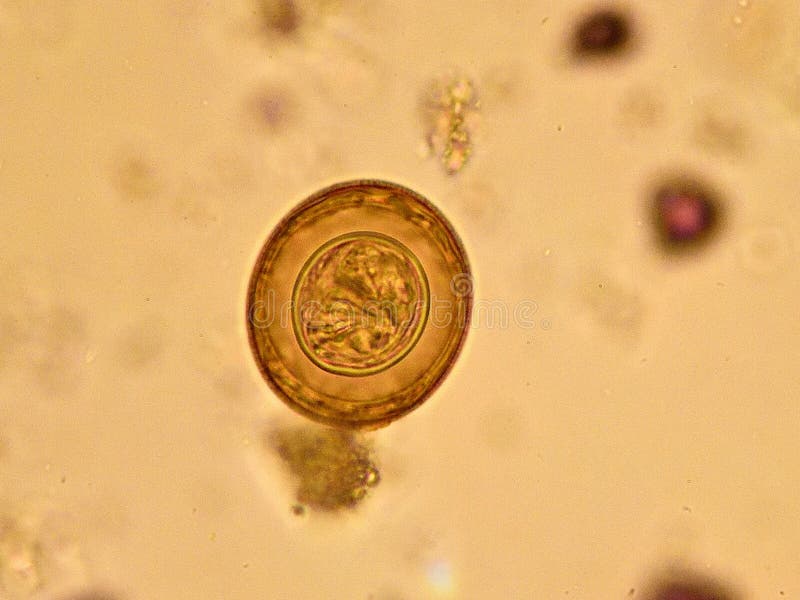 Hymenolepis diminuta stock photo. Image of nematoda, microbiology ...