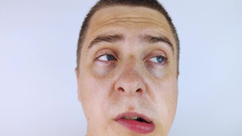 A Man with Sweating on His Face is Looking at the Camera. Sweat Gland ...