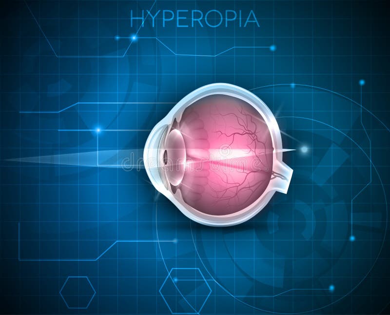 Far Sightedness and Near Sightedness Vector Illustration Diagram ...
