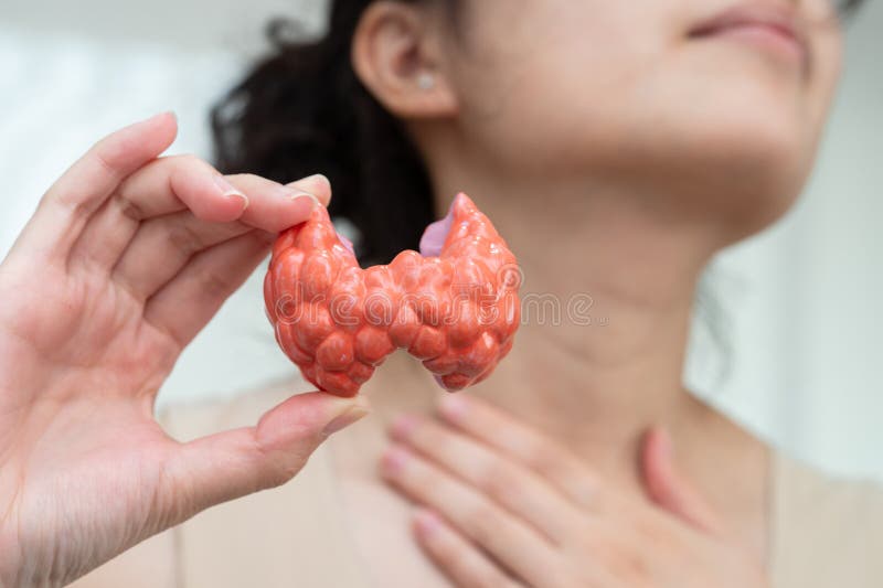 Hyperthyroidism, Overactive Thyroid, Thyroid Lymphoma, Asian Woman with ...