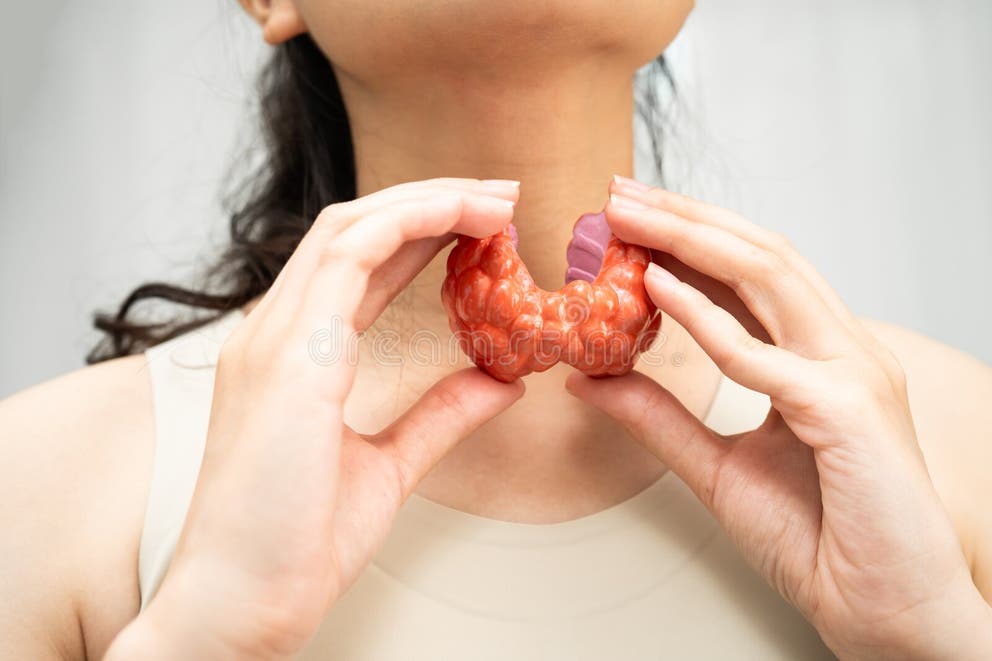 Hyperthyroidism, Overactive Thyroid, Thyroid Lymphoma, Asian Woman with ...