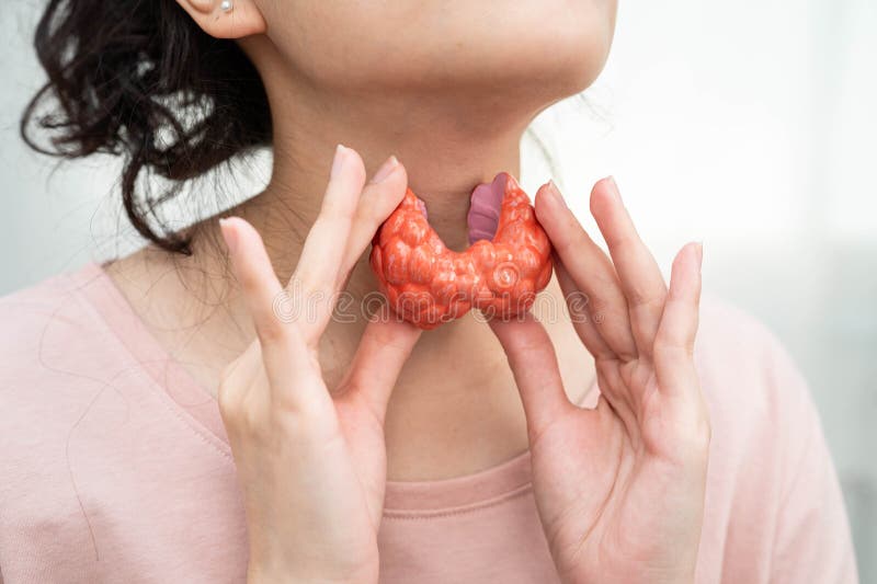 Hyperthyroidism, Overactive Thyroid, Thyroid Lymphoma, Asian Woman with ...