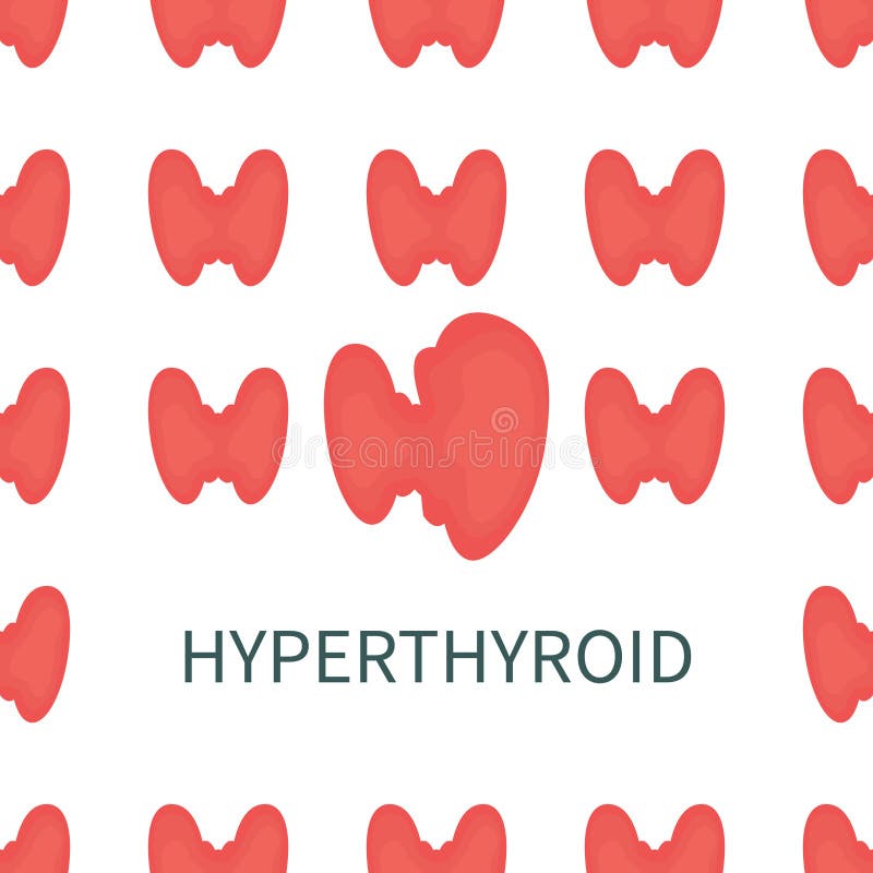 Gland with Healthy Thyroid and Hyperthyroid Disorder Stock Vector ...