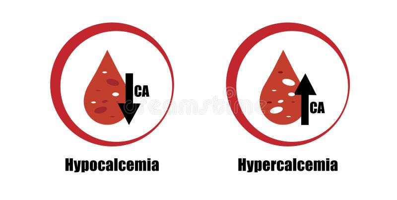 Hypocalcemia and Hypercalcemia Vector. Round Iicon Stock Vector ...