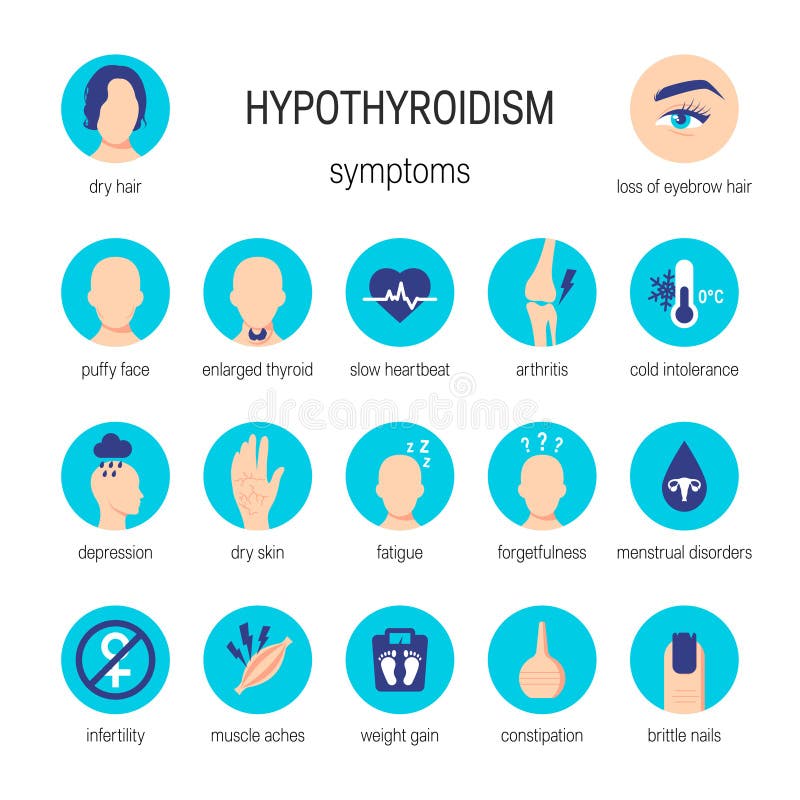 Hypothyroidism stock vector. Illustration of brittle - 74214618