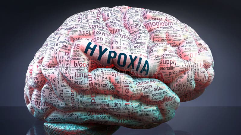 Hypoxia and a human brain stock illustration. Illustration of concepts ...