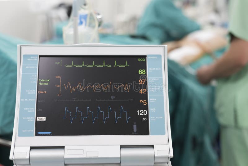 Iabp Used after Open Heart Surgery Stock Image - Image of cardio ...