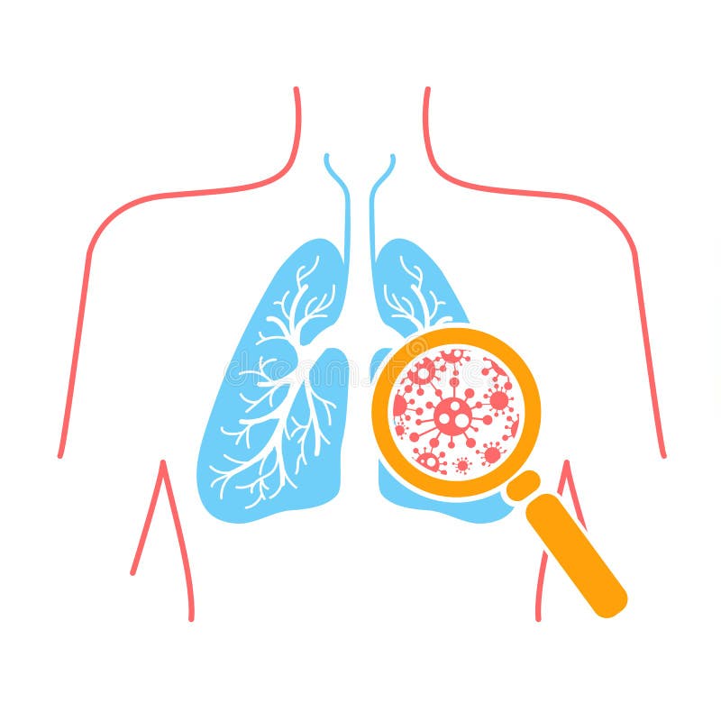 Pneumonie Stock Illustrations, Vecteurs, & Clipart – (90,792 Stock ...